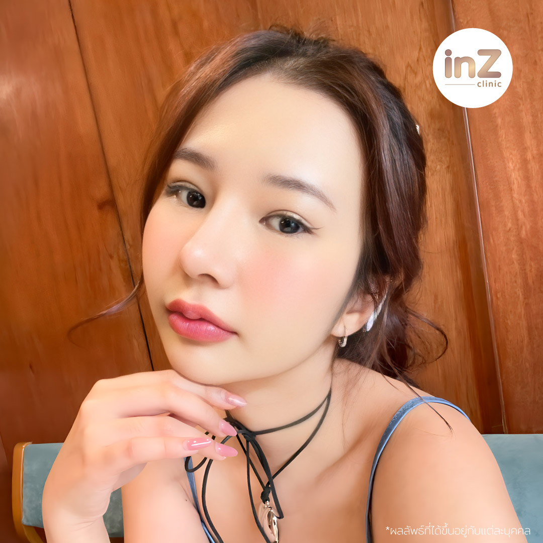 คุณมิ้น นัยรัตน์ - inZ Clinic