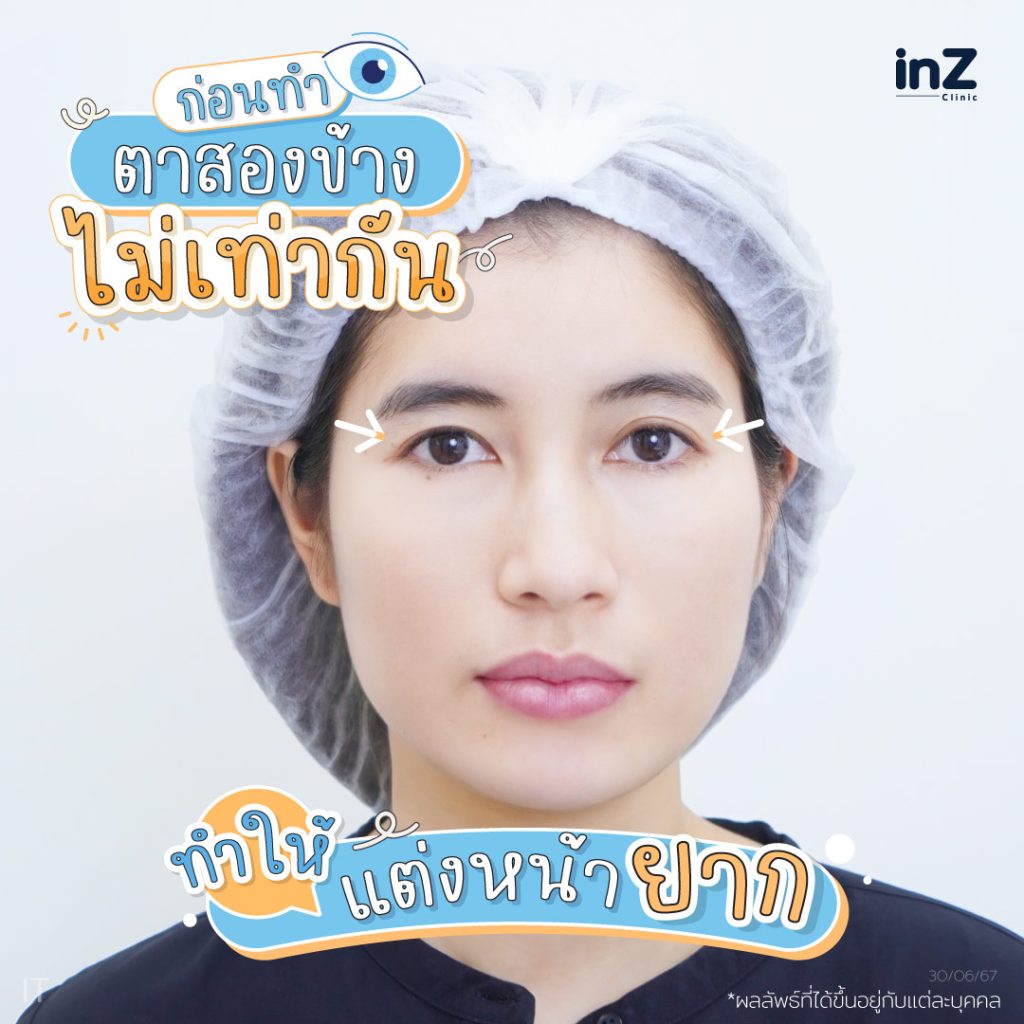 คุณออย - inZ Clinic