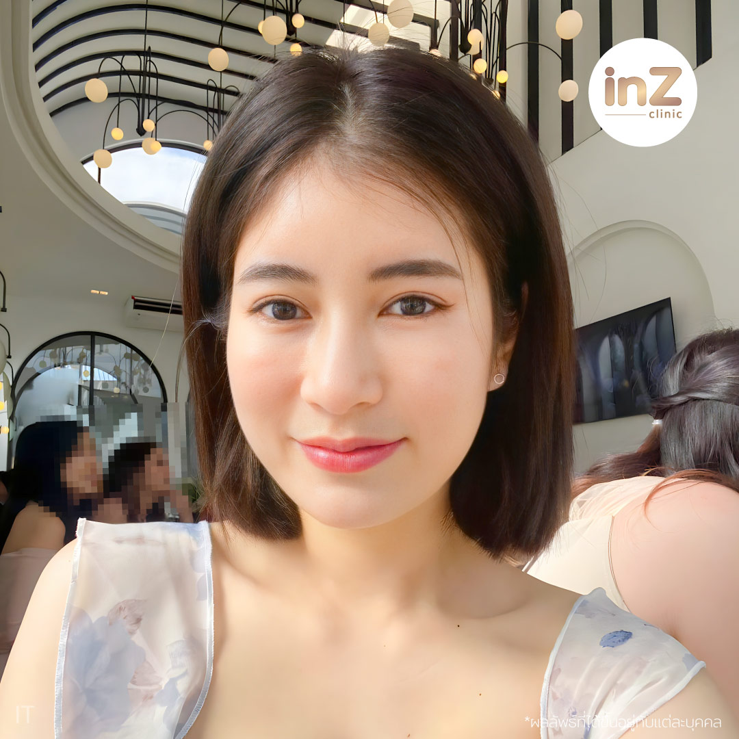 คุณออย - inZ Clinic