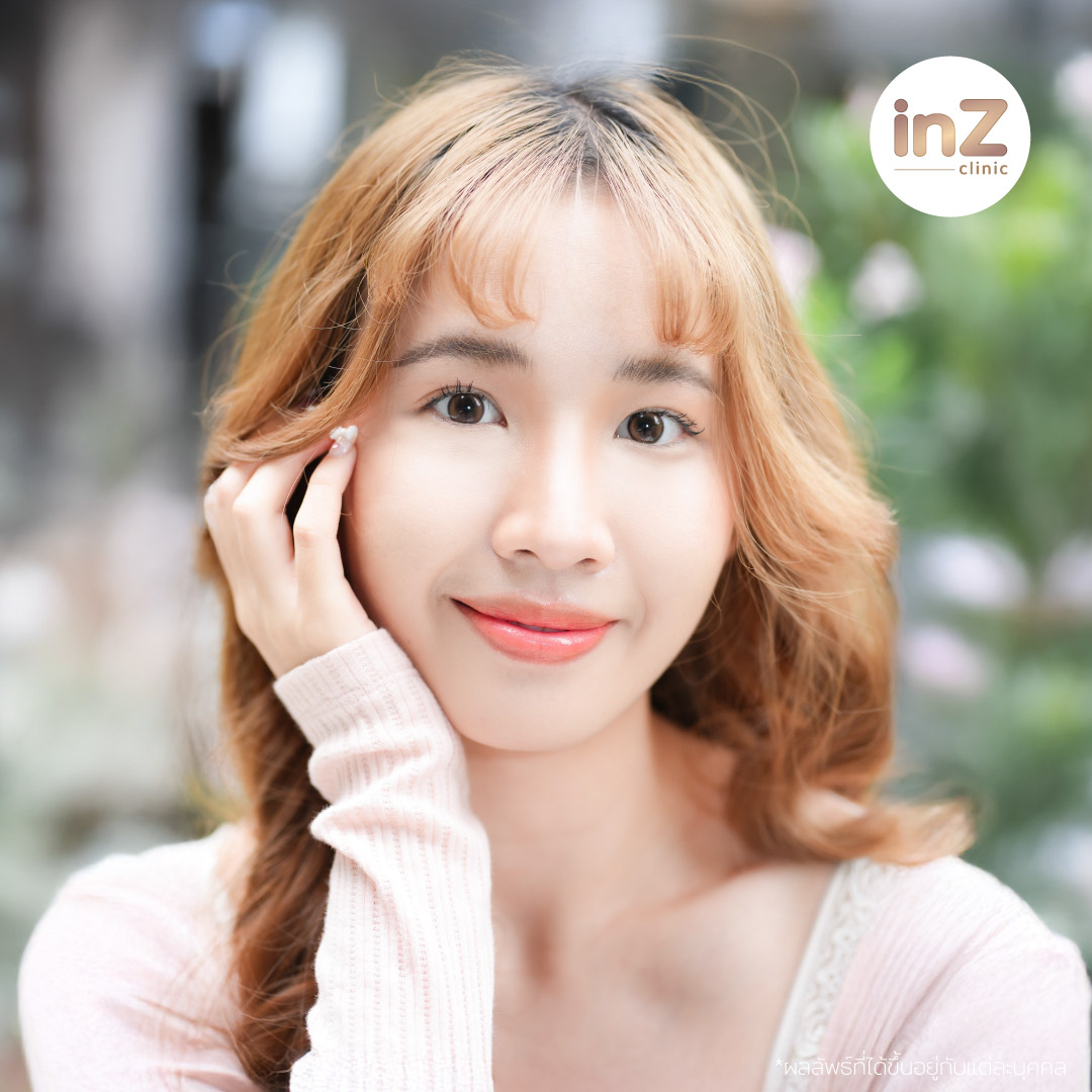 คุณมิยู ทากูลิ - inZ Clinic