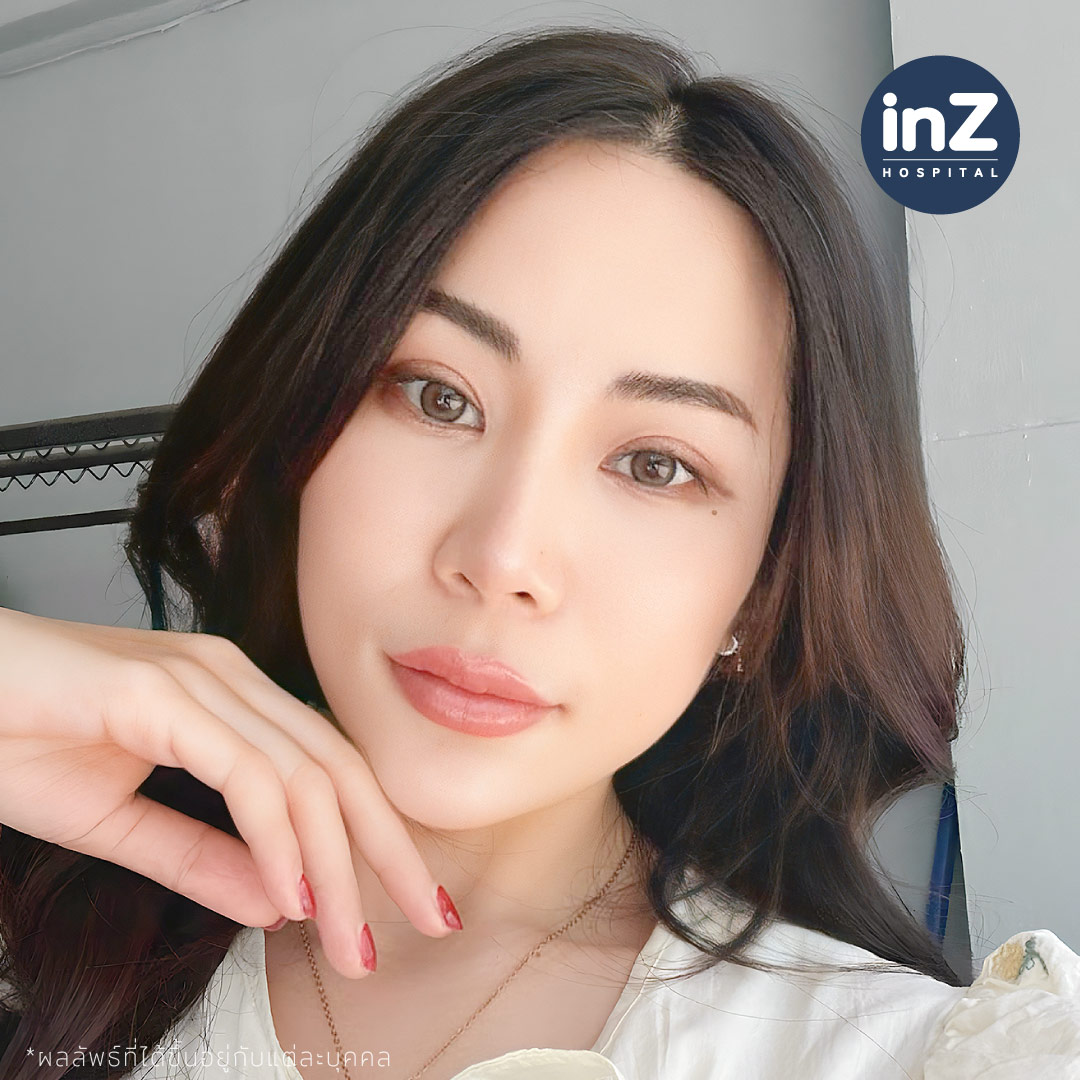 คุณส้ม ศศิวิมล - inZ Clinic