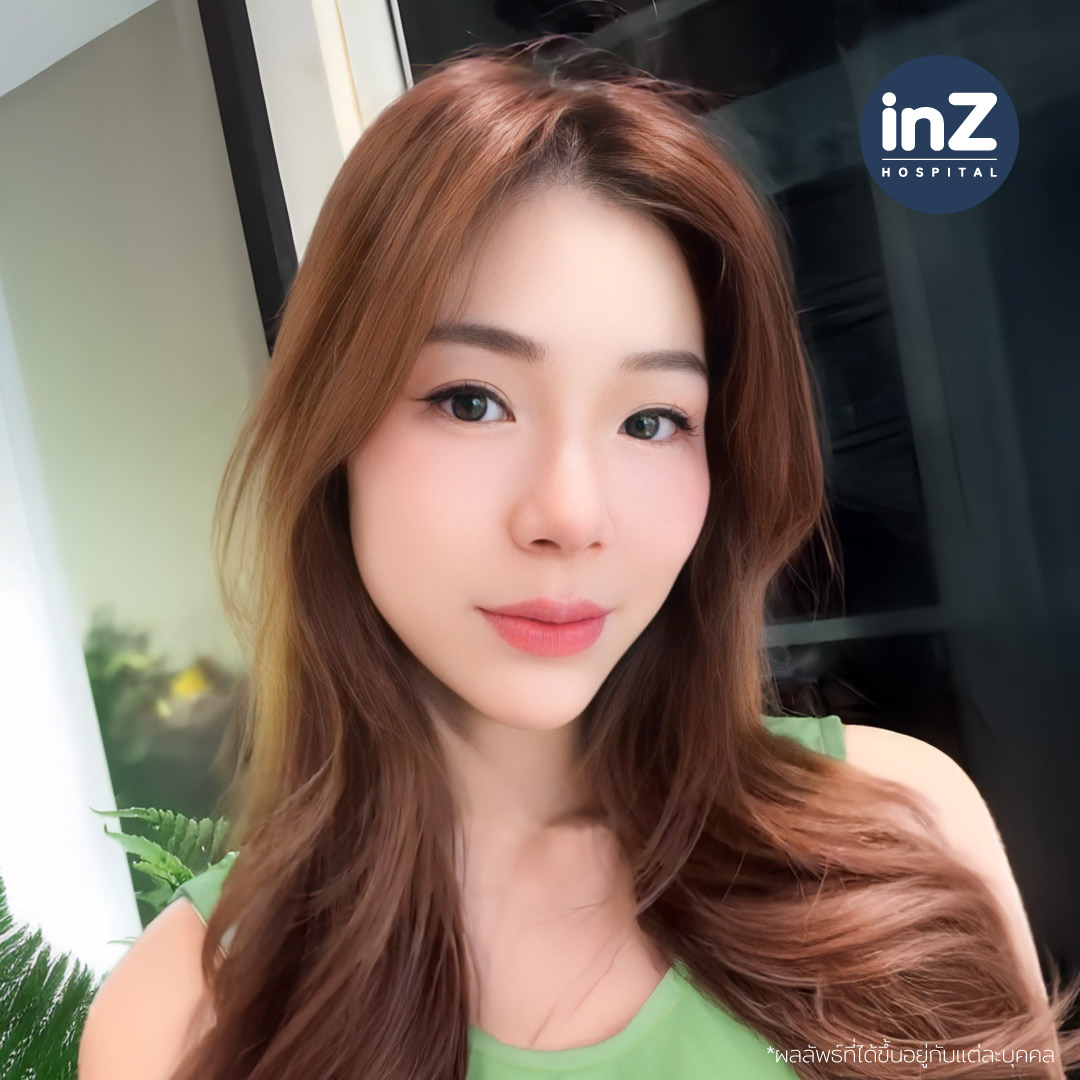 คุณโบ ชนัณชิดา - inZ Clinic